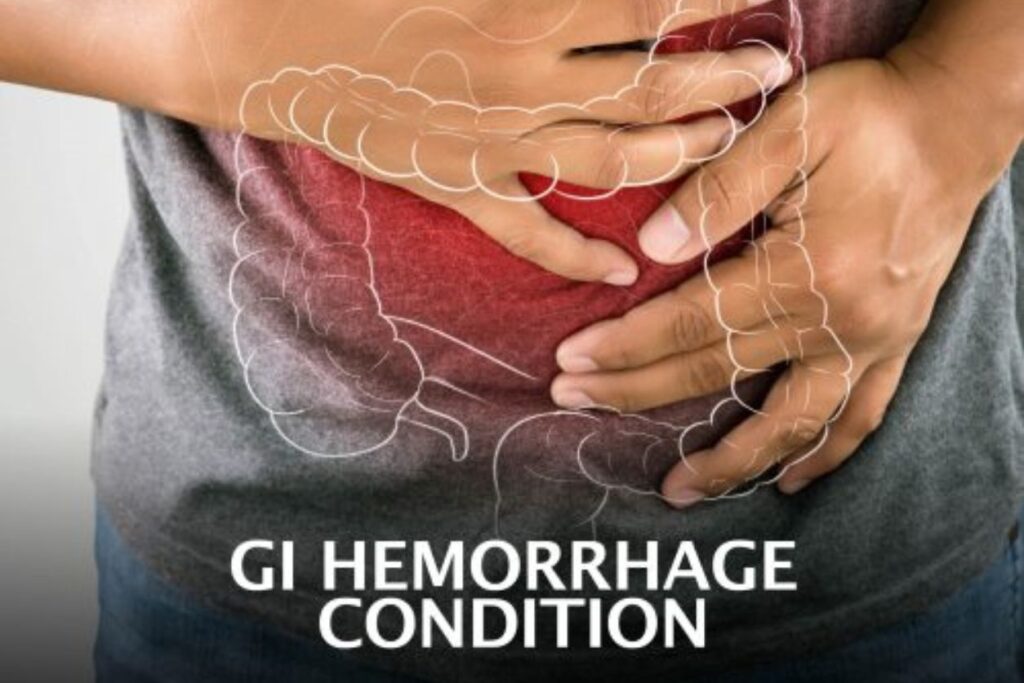 GI Hemorrhage Condition | Gastroenterology of Greater Orlando