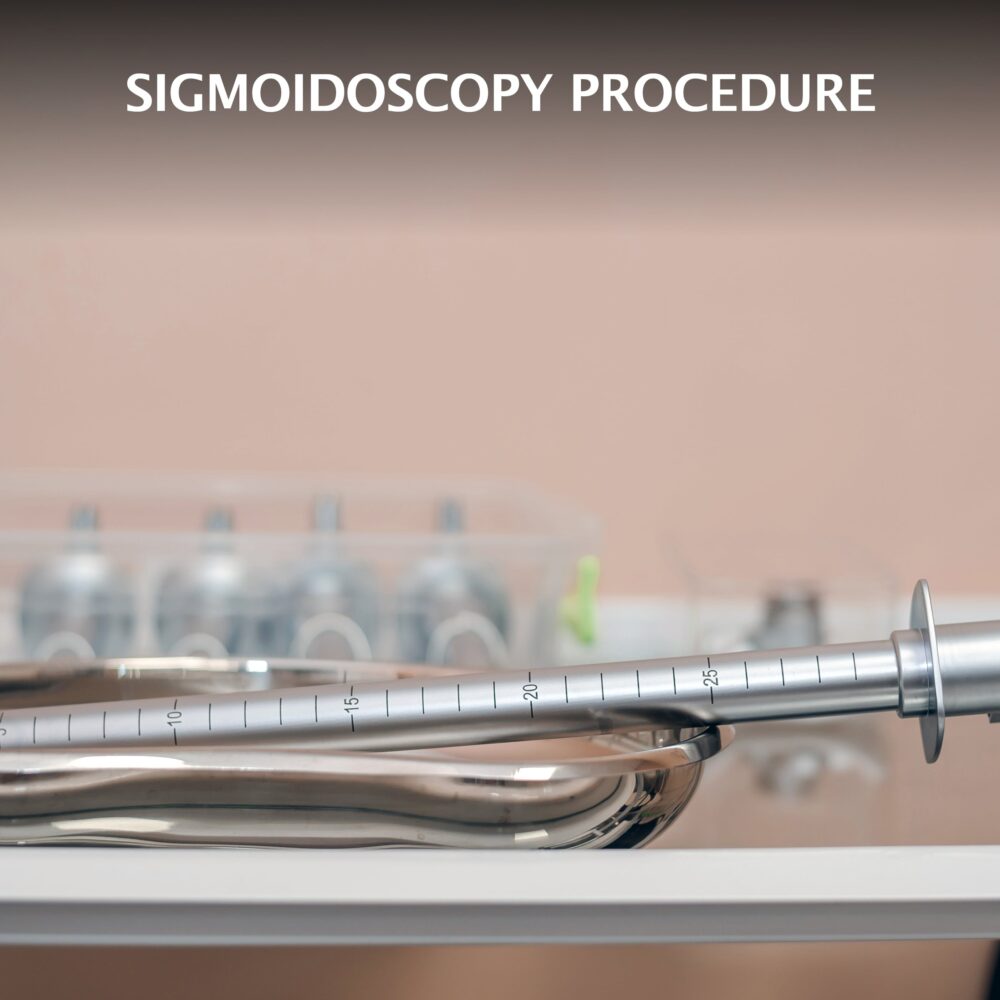 Sigmoidoscopy Procedure | Gastroenterology of Greater Orlando