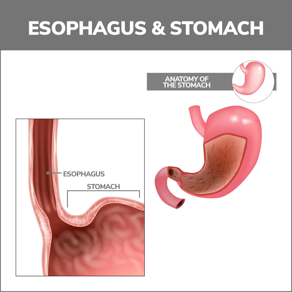 Esophageal Disorders | Gastroenterology of Greater Orlando