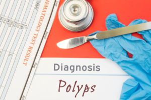 Colon and Rectal Polyps: What You Need to Know